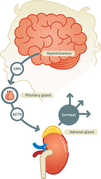 Cushing's Syndrome | NIDDK