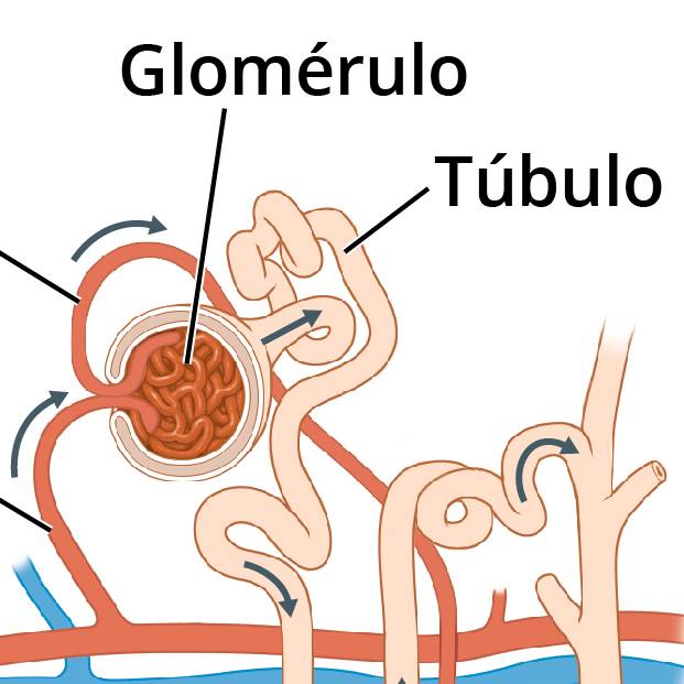 Enfermedad glomerular - NIDDK