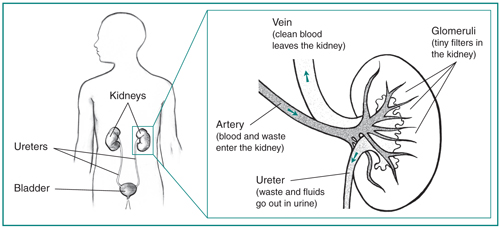 Nephrotic Syndrome in Adults | NIDDK