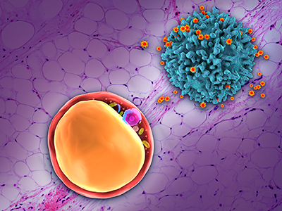 Obesity and Fat Metabolism in HIV Infected Individuals - 2018 - NIDDK