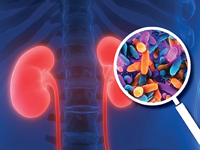 Gut Microbiota and Kidney Disease - 2024 - NIDDK