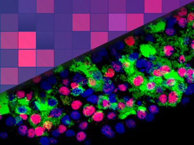 Beta Cell Replacement Therapies Workshop - 2022 - NIDDK