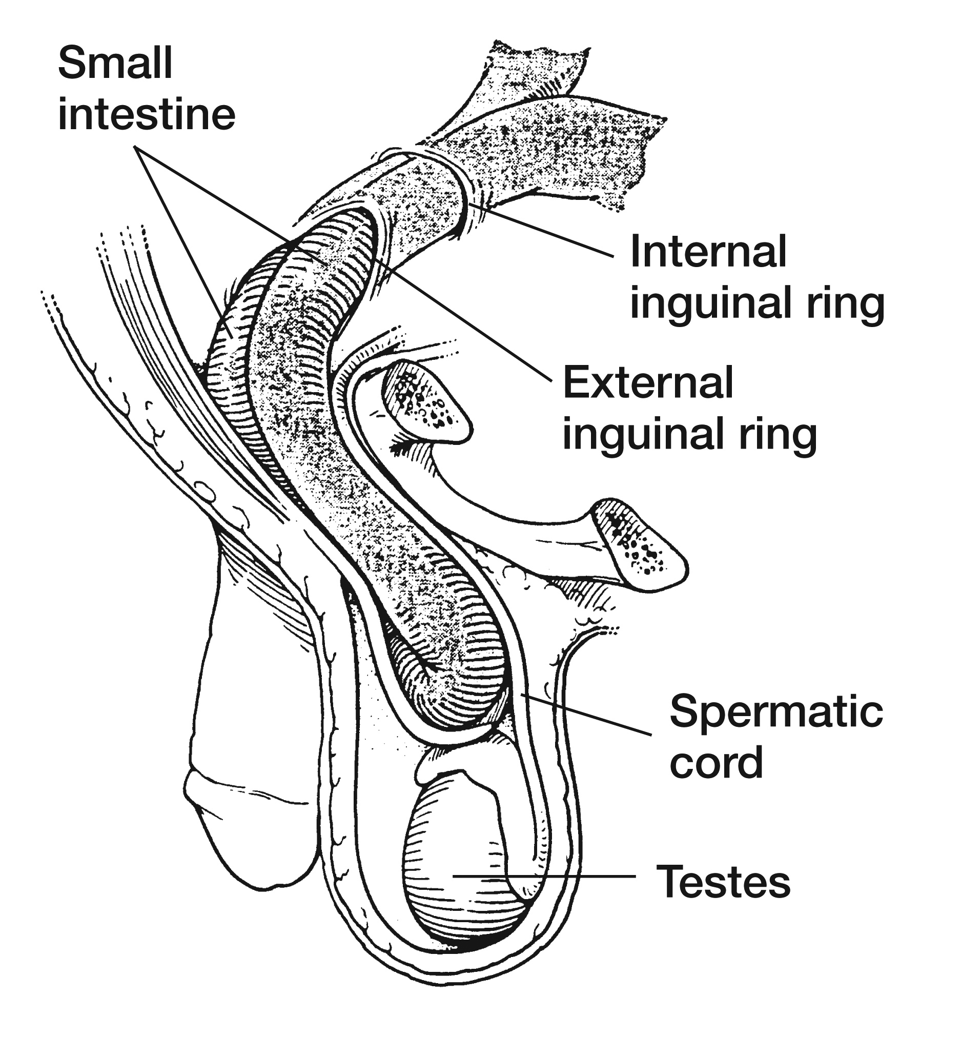 Internal Inguinal Ring Anatomy