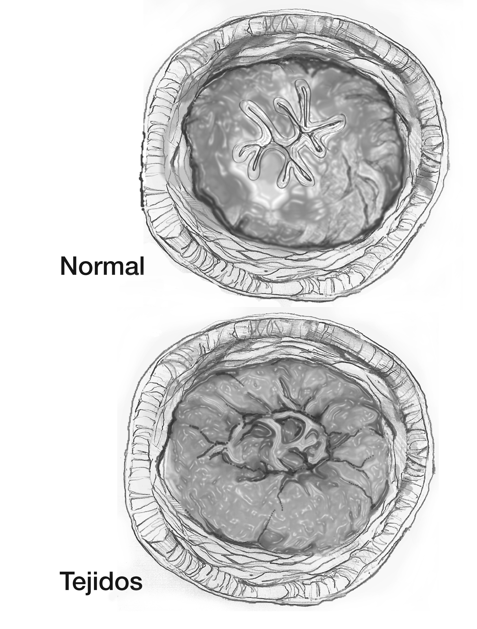 Secciones transversales del esófago | Media Asset | NIDDK