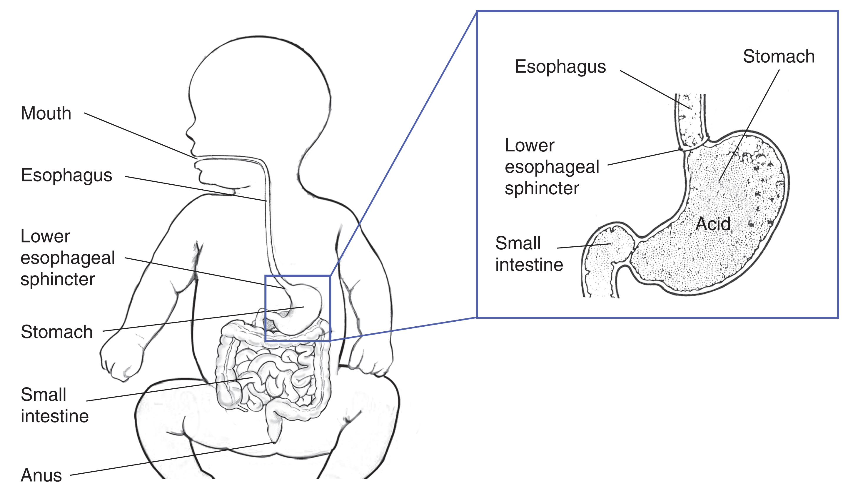 Infant digestive tract with inset showing cross section of stomach ...