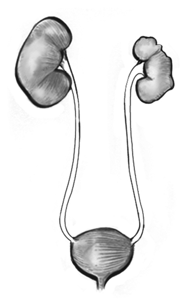 Urinary System No Labels